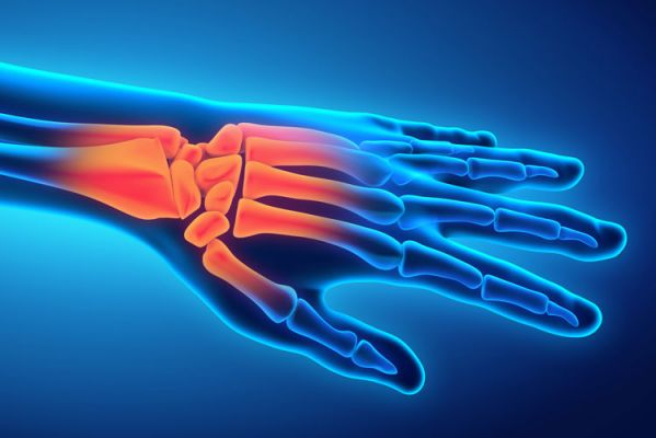 Operation am Handgelenk - Dr. med. Marc Felix